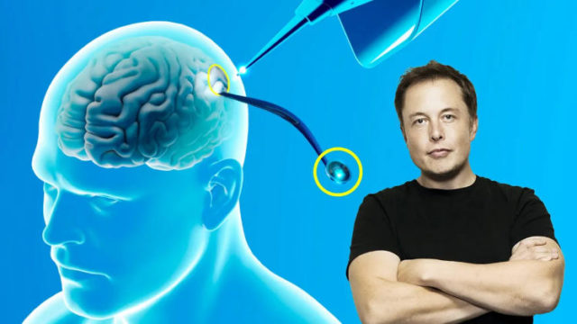 Elon Musk Desde Su Empresa Neuralink Ha Implantado El Primer Chip